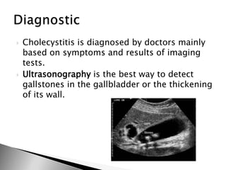 Chronic cholecystitis | PPTX