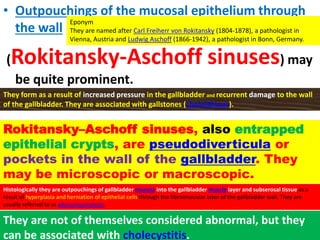 Chronic cholecystitis practical | PPTX