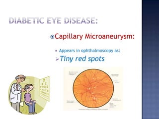 Chronic complications of diabetes mellitus | PPTX