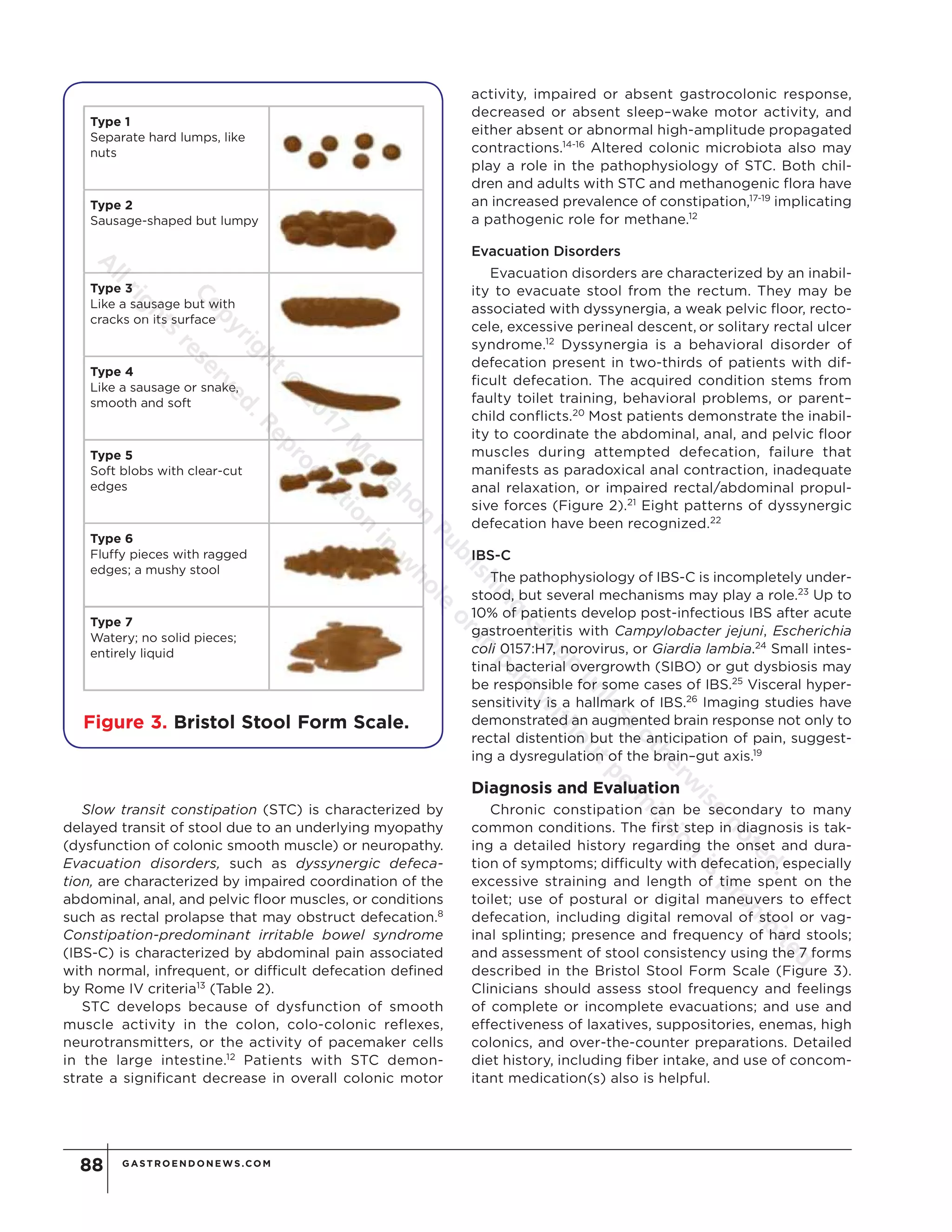 Chronic Constipation: Assessment and Treatment Options (Rao) | PDF