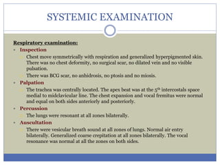 Chronic cough | PPTX