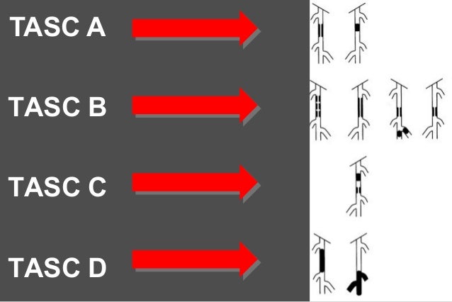 Chronic critical limb ischemia