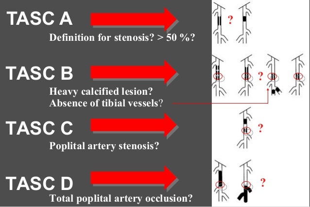 Chronic critical limb ischemia