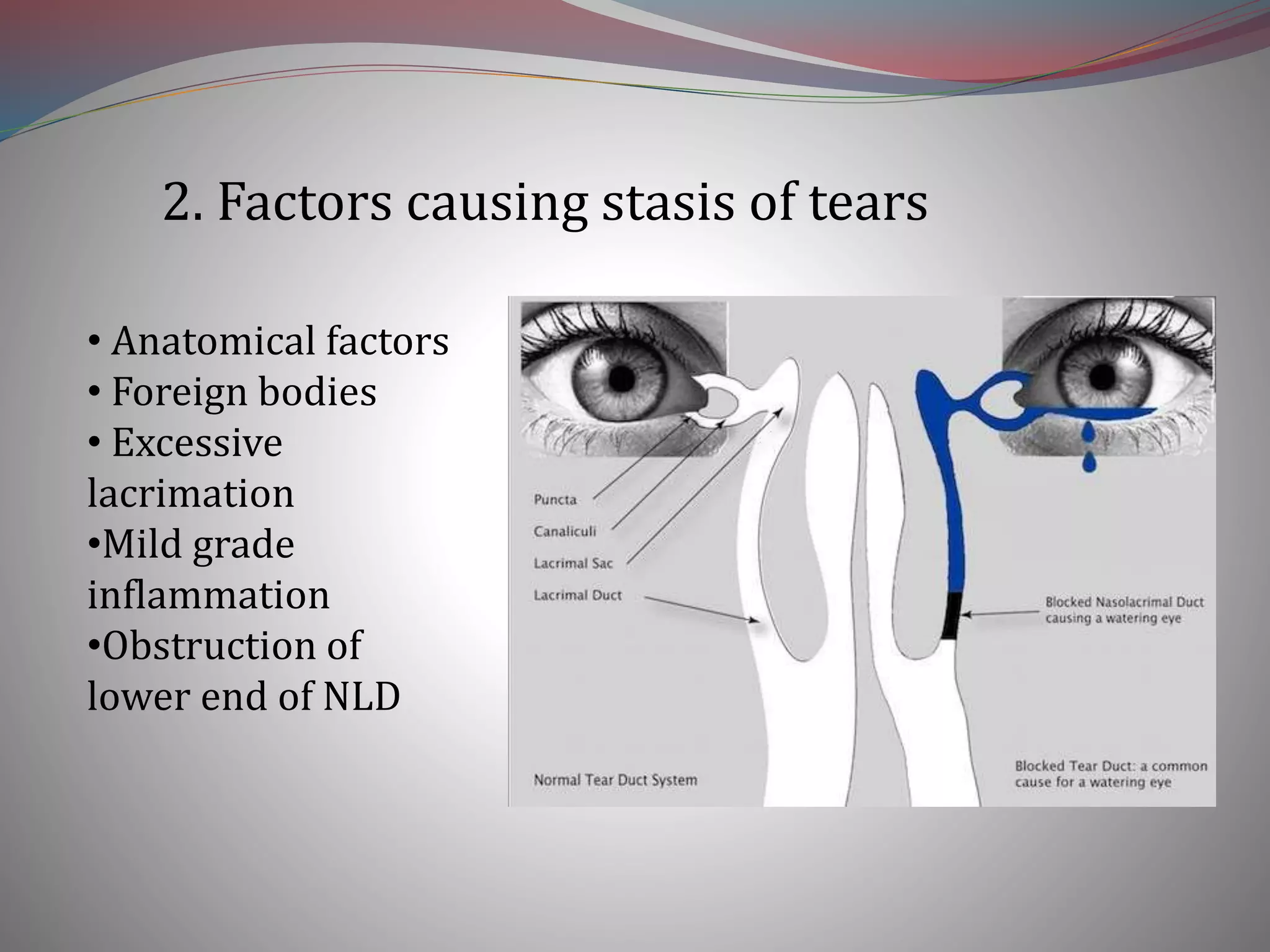 Chronic dacryocystitis | PPTX
