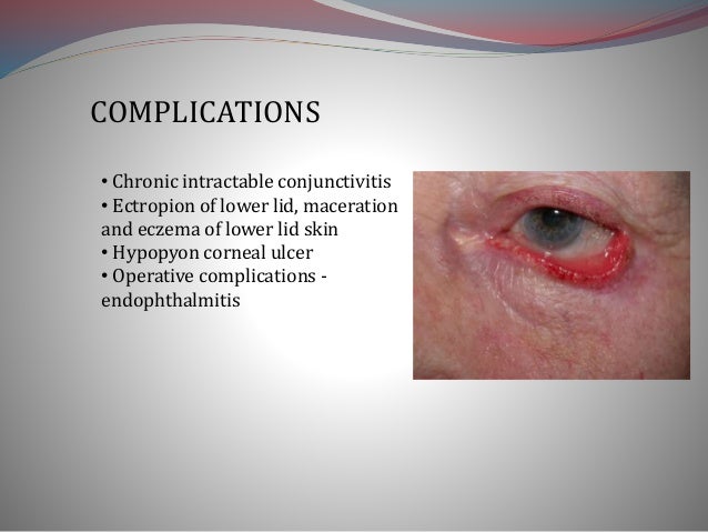 Chronic dacryocystitis