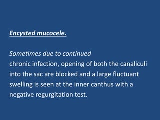 Chronic dacryocystitis Quick Review | PPTX