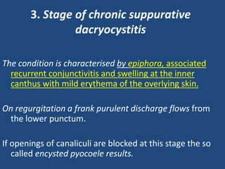 Chronic dacryocystitis Quick Review | PPTX