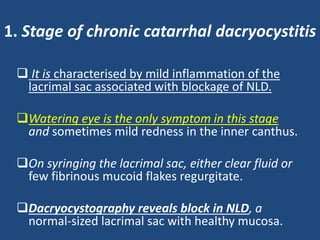 Chronic dacryocystitis Quick Review | PPTX