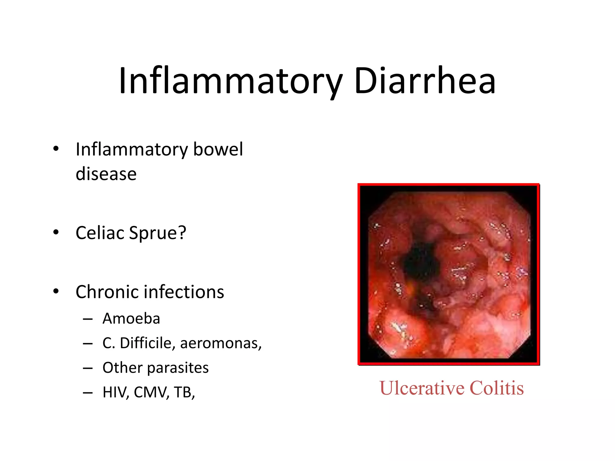 Chronic diarhea and malabsorption | PPT