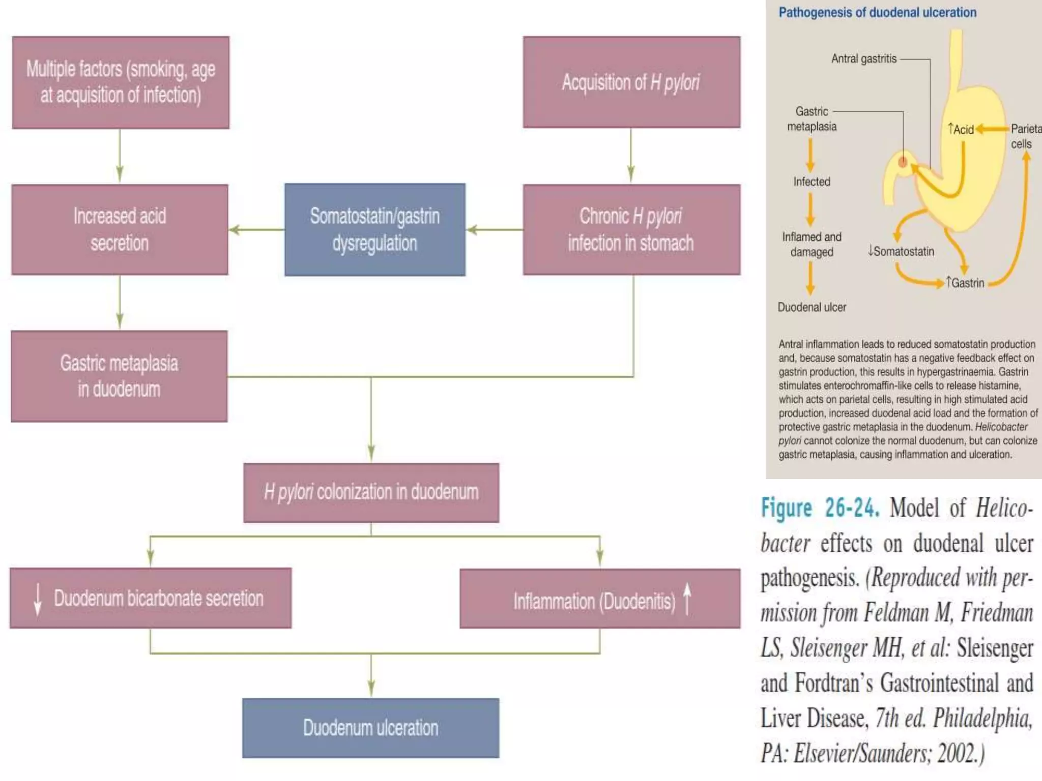 Chronic epigastric pain | PPTX