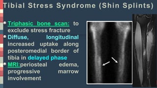 Chronic Exertional Compartment Syndrome | PPTX