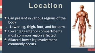 Chronic Exertional Compartment Syndrome | PPTX