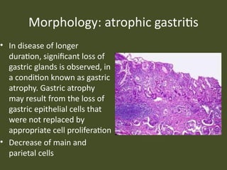 Chronic gastritis. GERD. Peptic ulcer (1).pptx