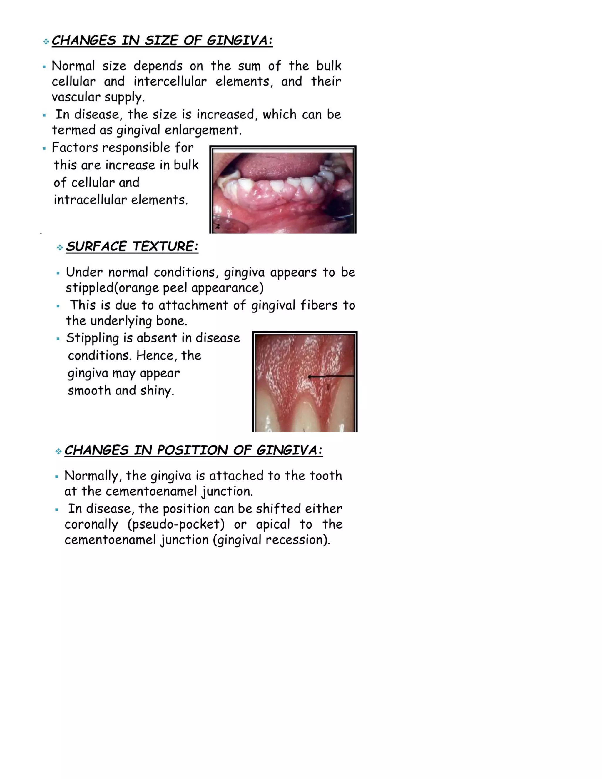 Chronic gingivitis | PDF
