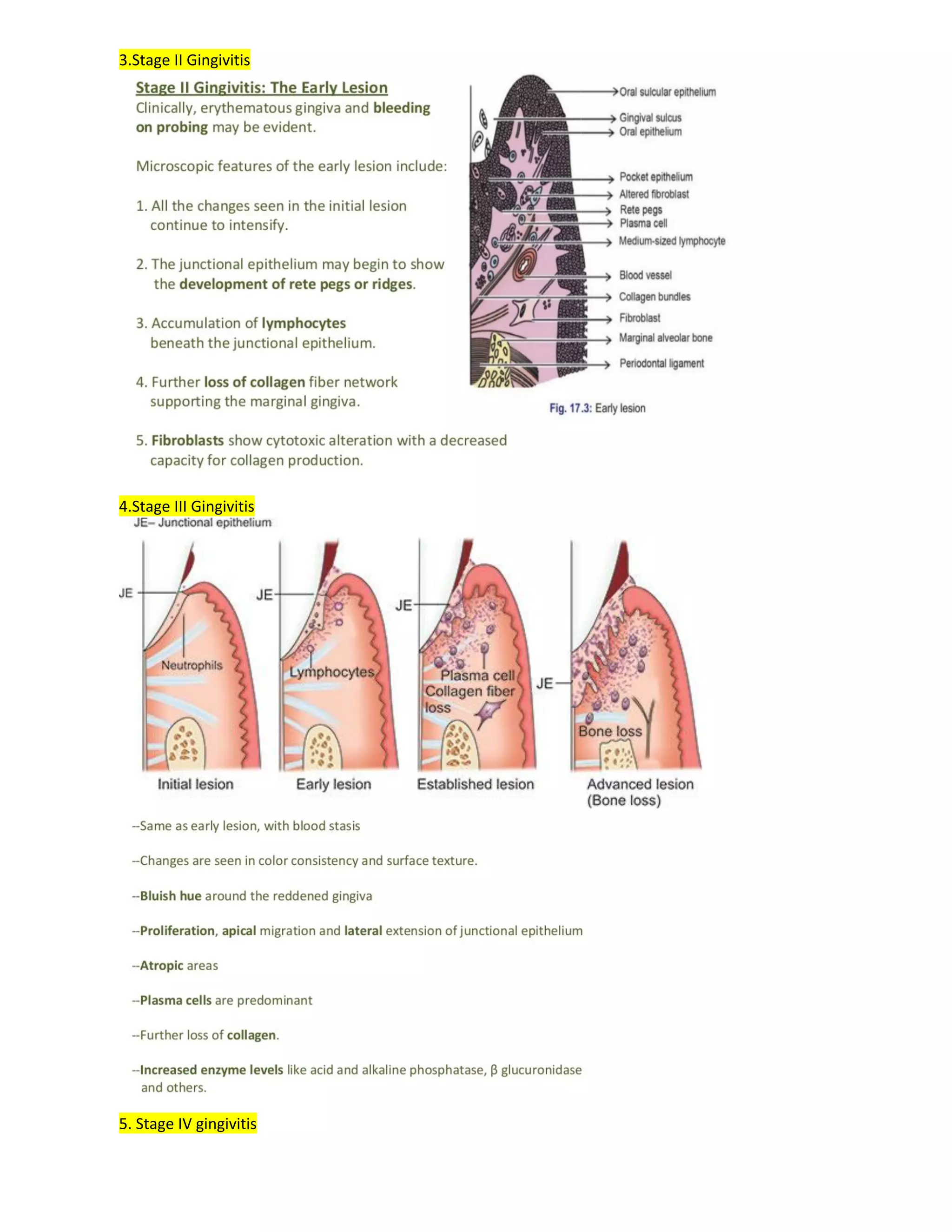 Chronic gingivitis | PDF