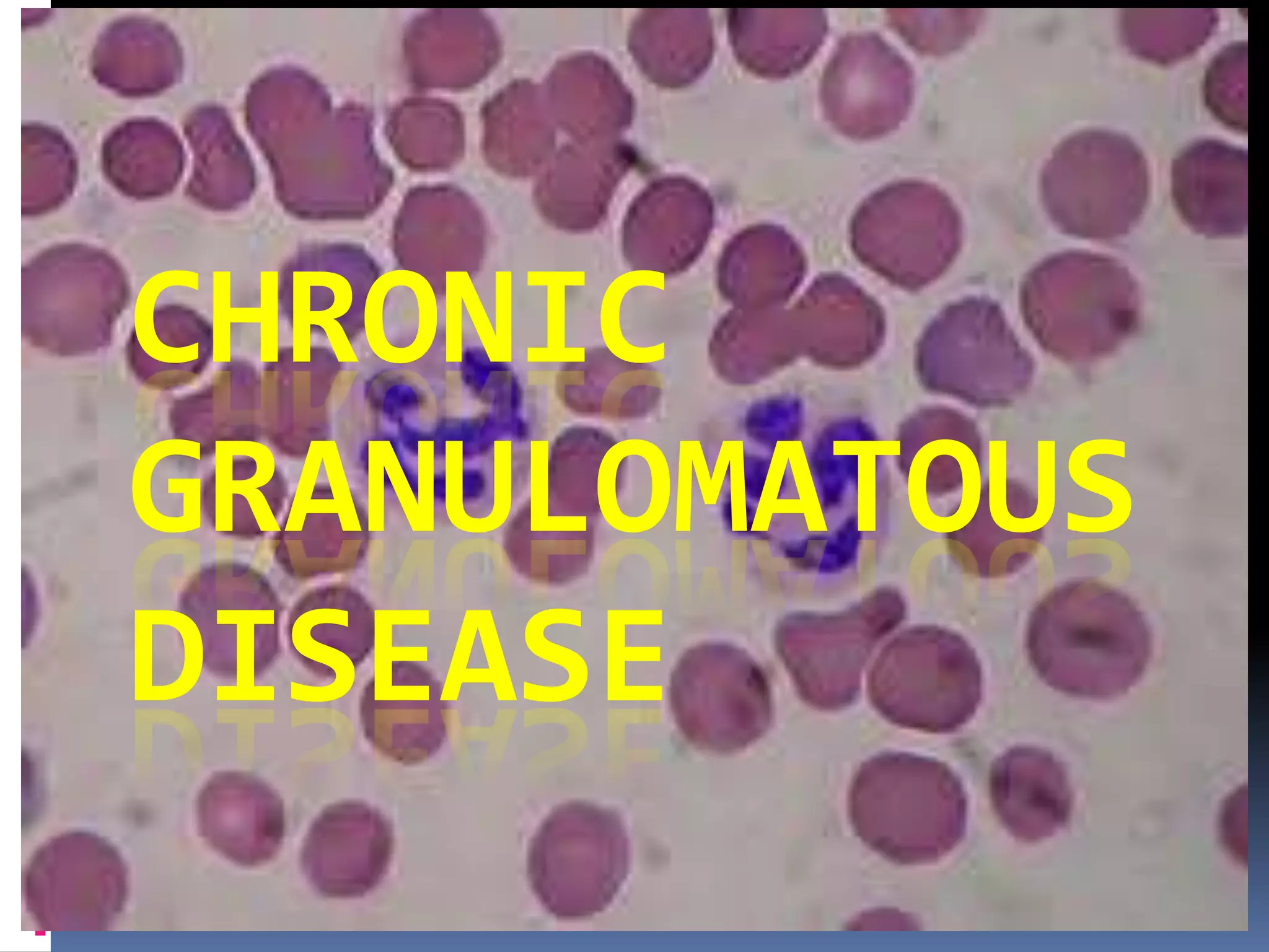 Chronic granulomatous disease | PPTX