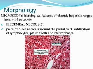 Chronic hepatitis | PPTX