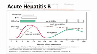 Chronic hepatitis b | PPTX