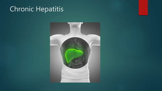 Chronic hepatitis, liver cirrhosis, chronic pancreatitis | PPTX