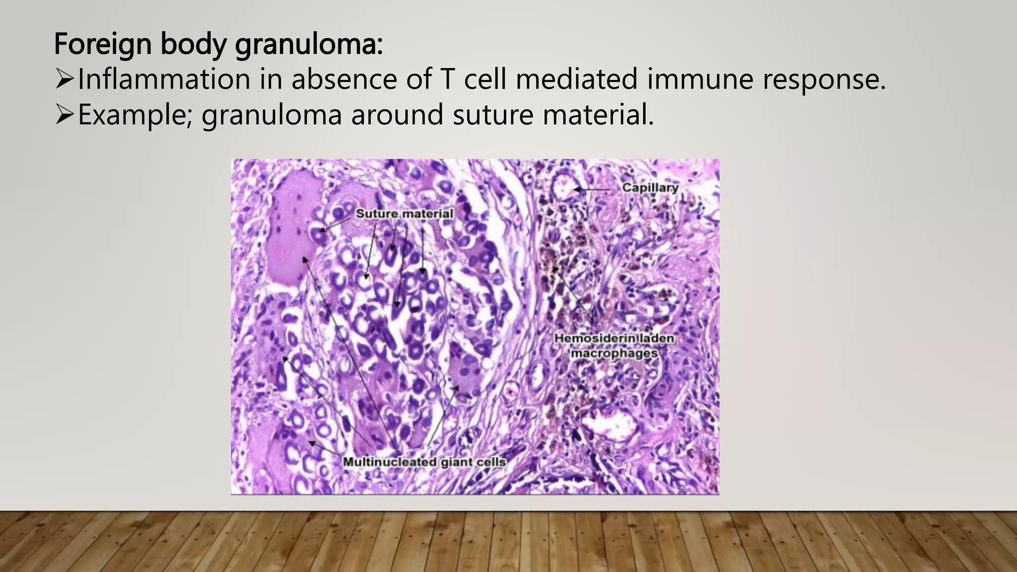 chronic inflamation | PPTX