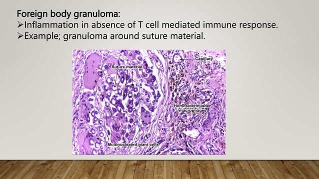 chronic inflamation | PPT