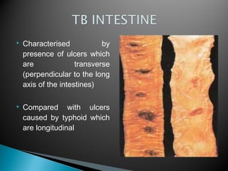 Chronic inflammation | PPT