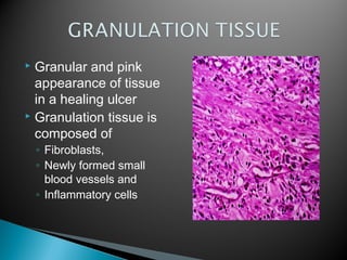 Chronic inflammation | PPT