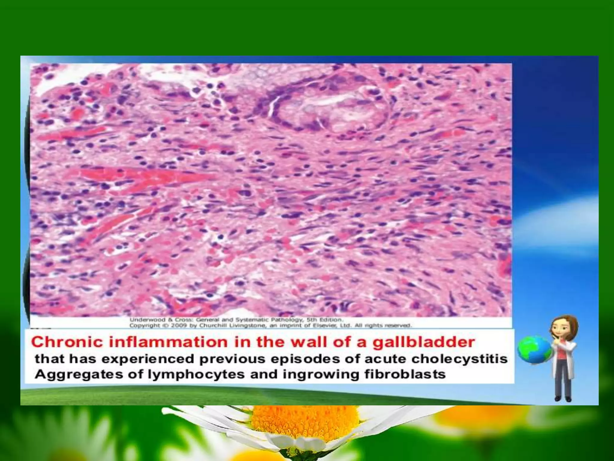 Chronic inflammation ppt | PPTX