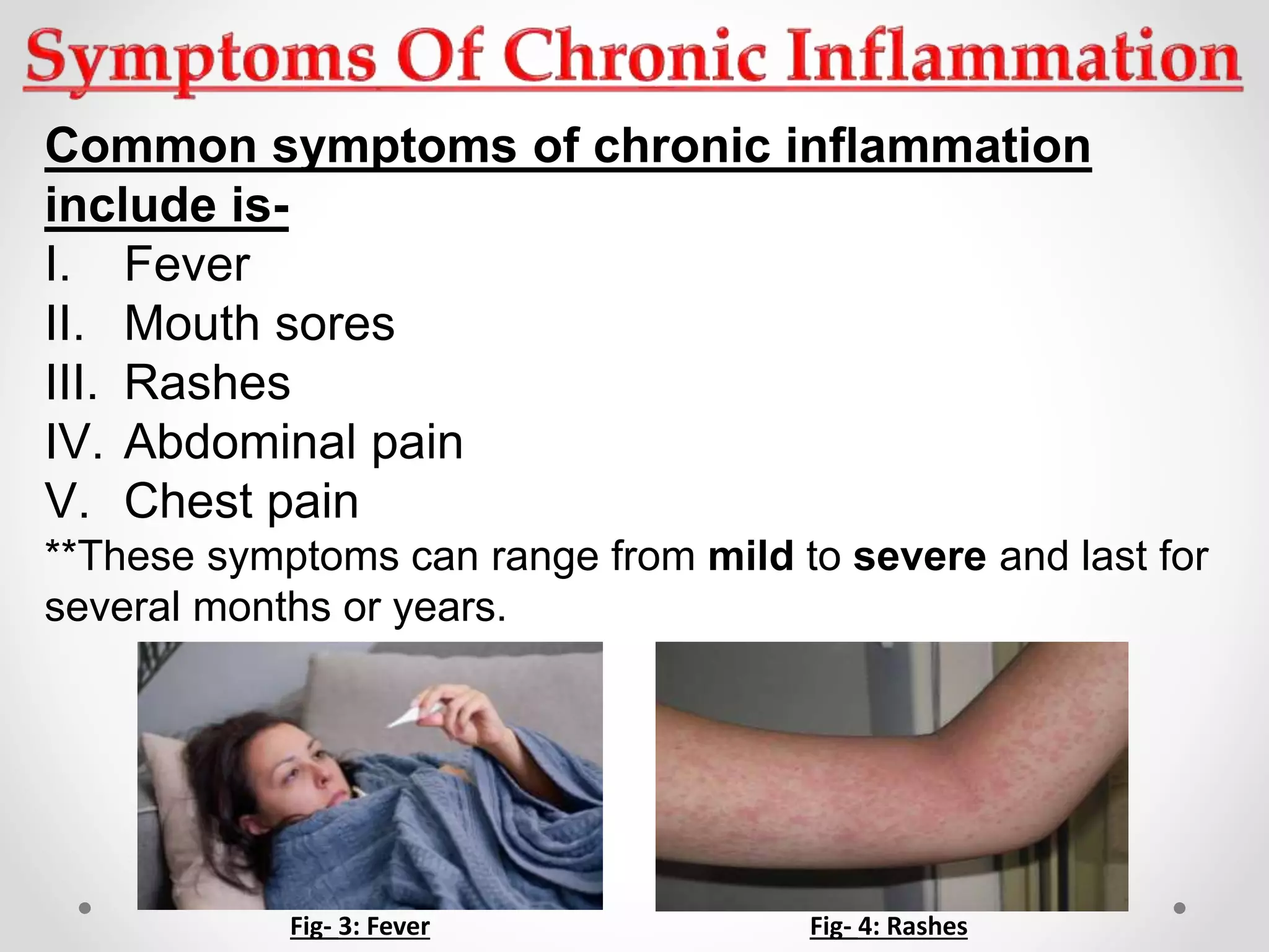 Chronic Inflammation by Akash Das | PPTX