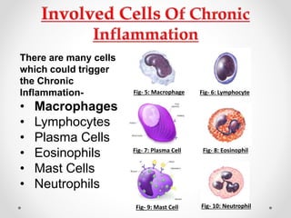 Chronic Inflammation by Akash Das | PPTX