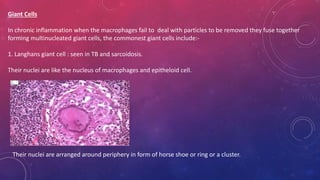 Chronic inflammation | PPTX