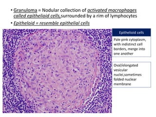 chronic inflammation.pdf