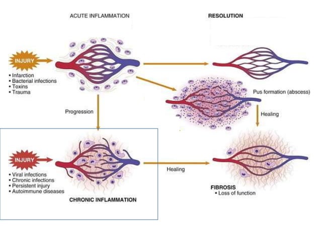 chronic inflammation.pdf