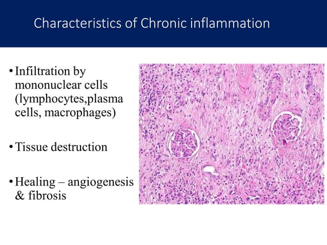 chronic inflammation.pdf