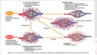Chronic Inflammation and tissue Repair for pharmacy | PDF
