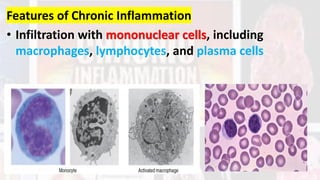 Chronic Inflammation and tissue Repair for pharmacy | PDF