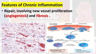 Chronic Inflammation and tissue Repair for pharmacy | PDF