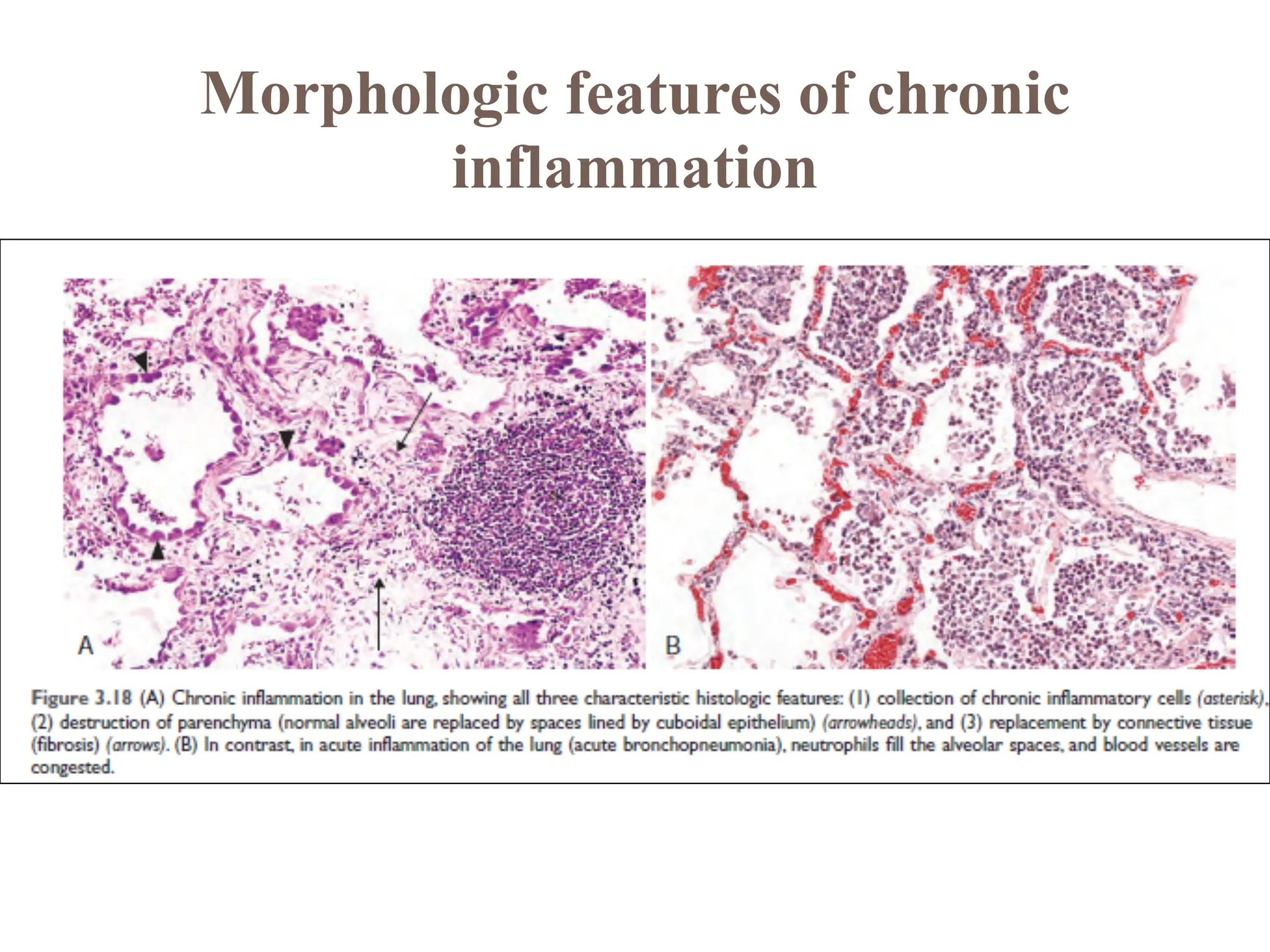 Chronic inflammation BSc Nursing.pdf bsc | PPT