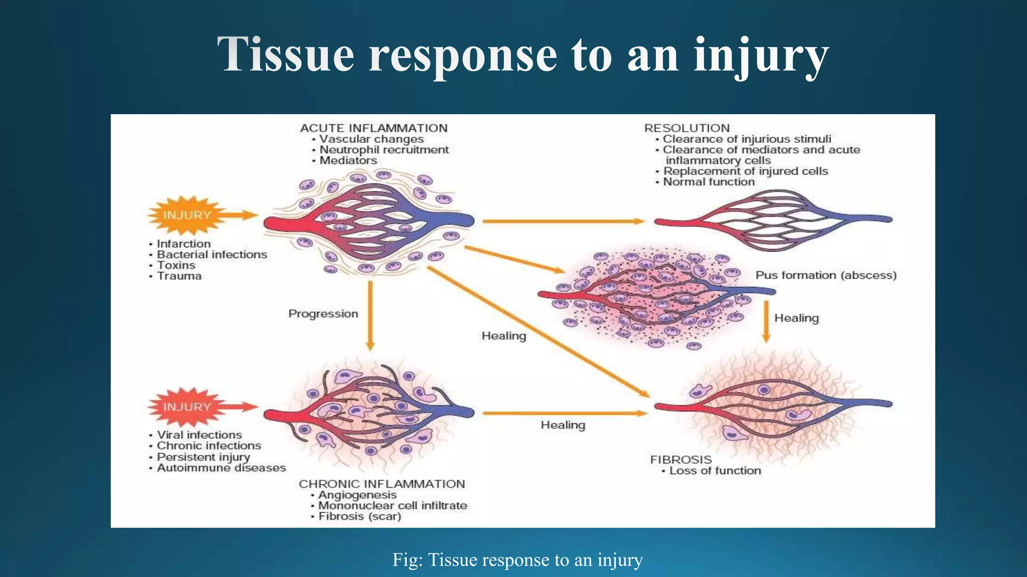 Chronic inflammation | PPTX