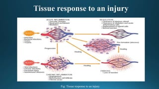 Chronic inflammation | PPTX