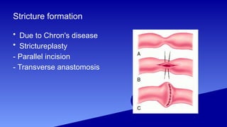 chronic intestinal obstruction in pakistan | PPTX
