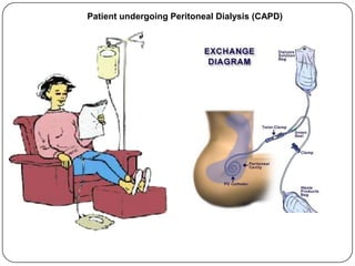 Chronic kidney disease | PPT