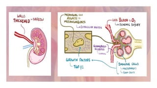 Chronic Kidney Disease (Case Study) | PPTX
