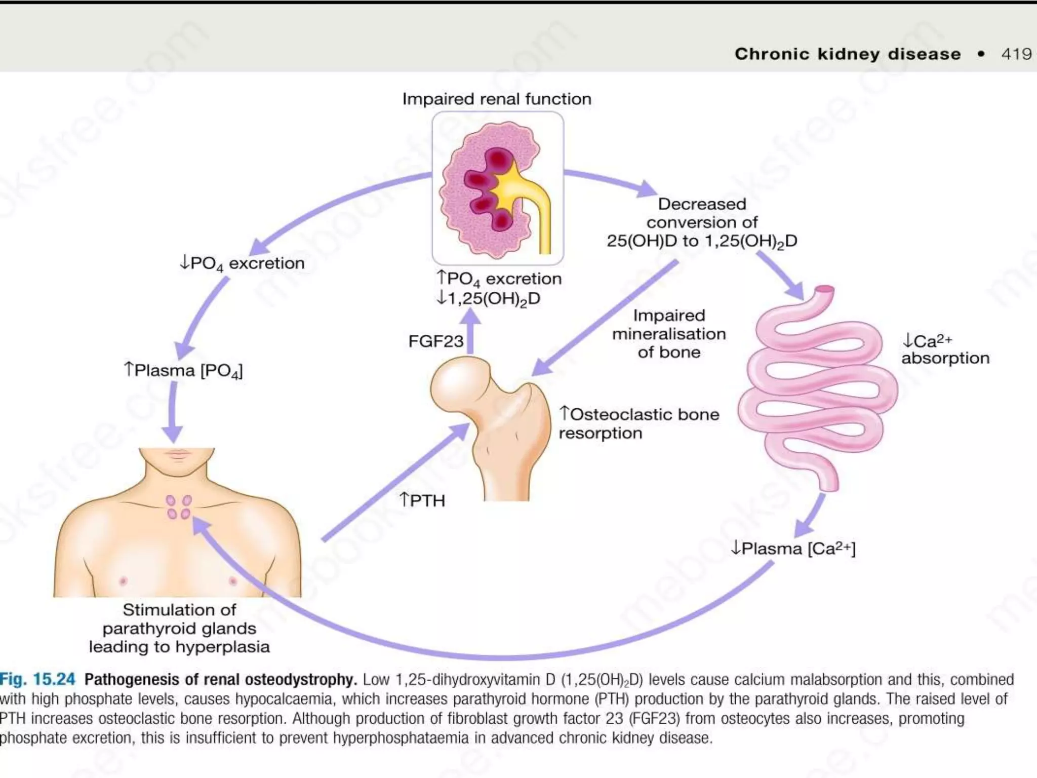 Chronic kidney disease(ckd) | PPTX