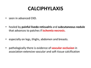 CKD : MBD Metabolic Bone Disease | PPTX