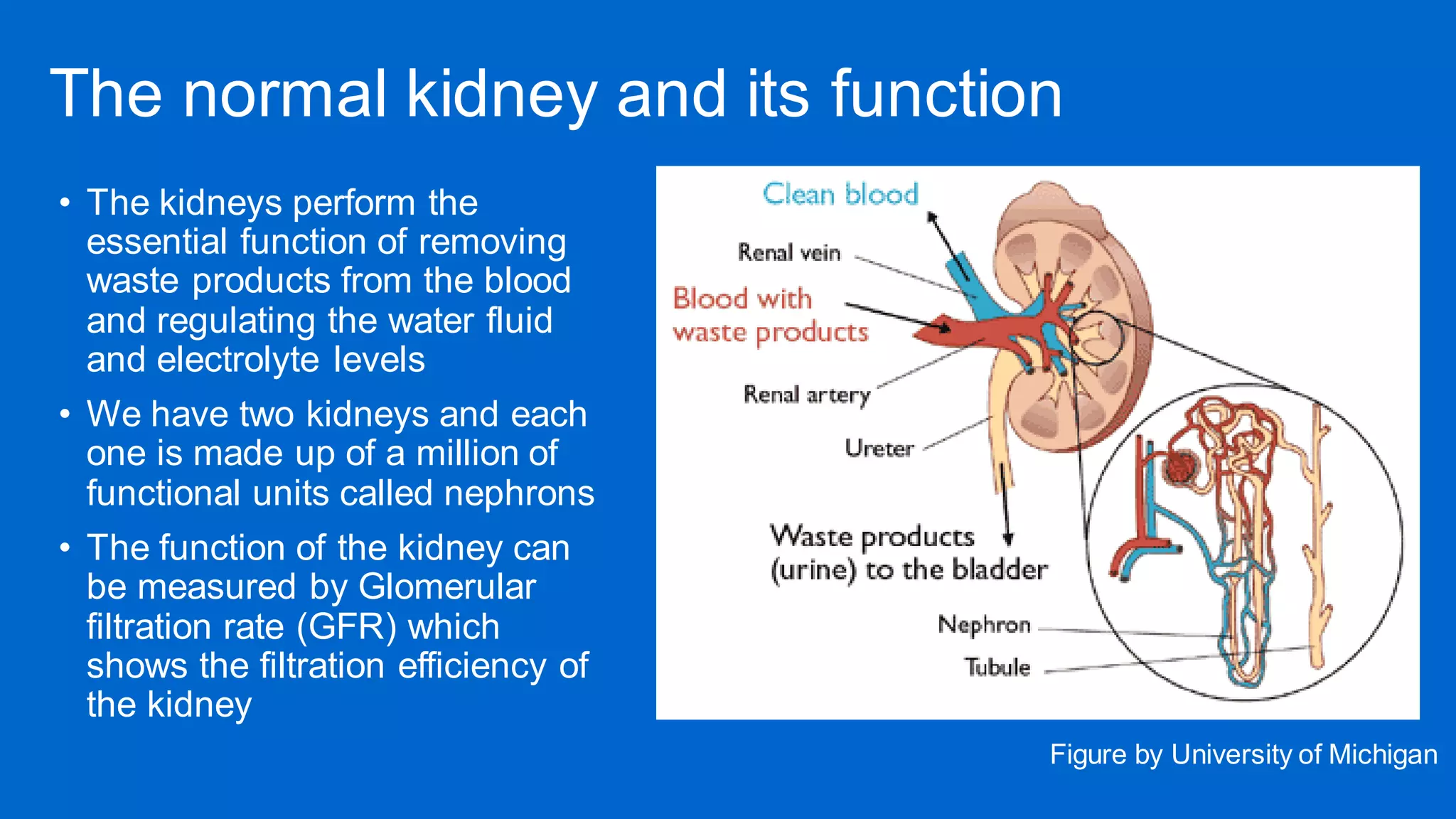 Chronic kidney disease of unknown aetiology (CKDu) in Sri Lanka: A ...