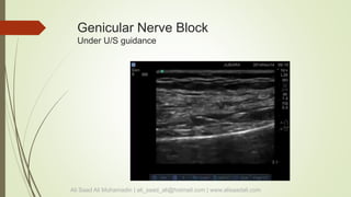 Chronic knee pain care pathway | PPTX