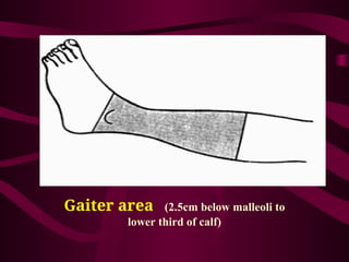 Chronic leg ulcer high critical topic for learning .ppt