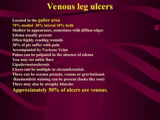 Chronic leg ulcer high critical topic for learning .ppt