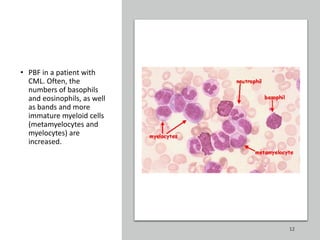INTRODUCTION TO CHRONIC LEUKEMIA WHITE BLOOD CELLS MALIGNANCY | PPT